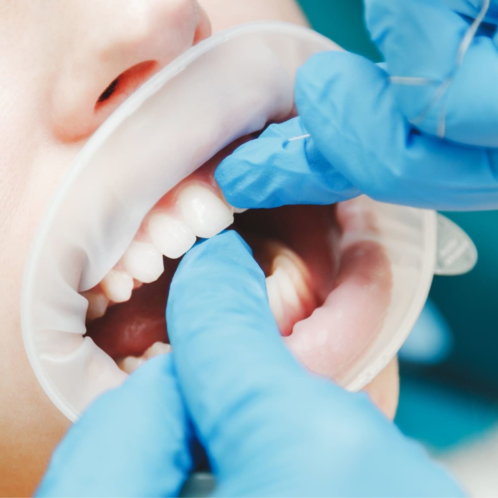 Medical Services Elementor Wordpress Theme - Phlox Pro